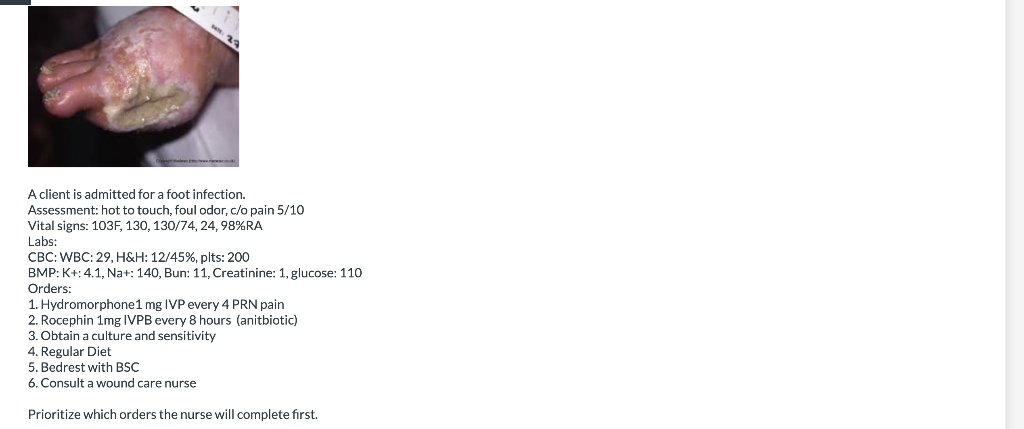 Solved A client is admitted for a foot infection. | Chegg.com