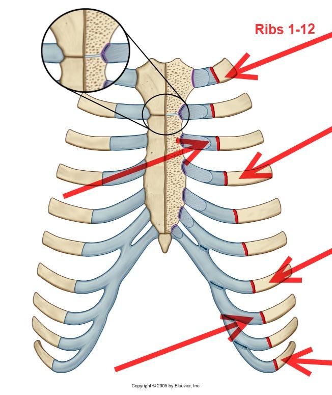 Costochondral Junction