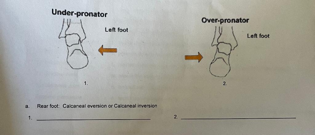 Solved Under_nrawaca- Over-pronator Left foot 2. a. Rear | Chegg.com