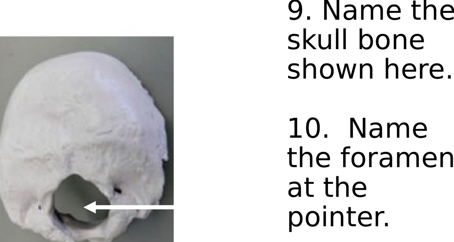 Solved 8. Name the skull bone at the pointer. 23 9. Name | Chegg.com