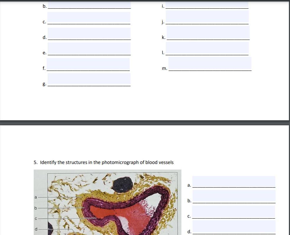 Solved Unit 22: Anatomy of Blood Vessels Worksheet 1. Which | Chegg.com