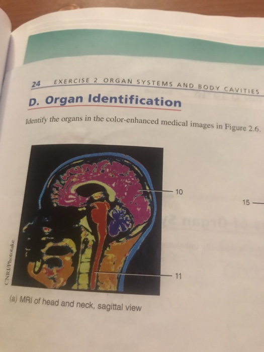Figure 26 Identification Of Organs On Medical Images - Images Poster