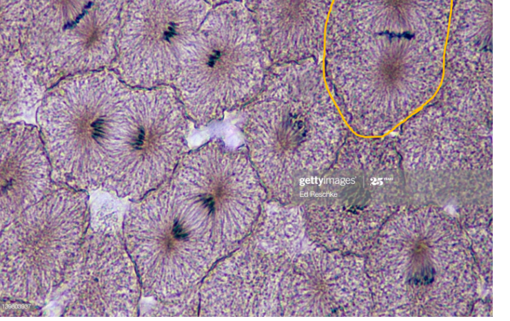 Solved The micrograph below shows the same embryo at much | Chegg.com