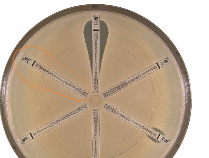 Solved What is the MIC for the PTC (drug) etest? which | Chegg.com