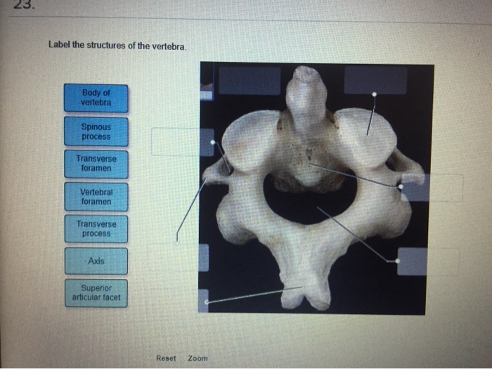 Solved 23 Label the structures of the vertebra Transverse | Chegg.com