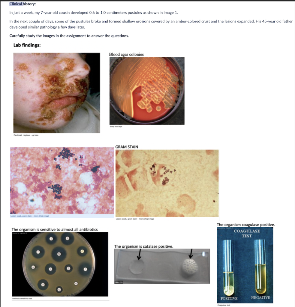 Staphylococcus Epidermidis Infections