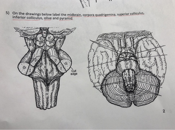 On the drawings below label the midbrain, corpora | Chegg.com