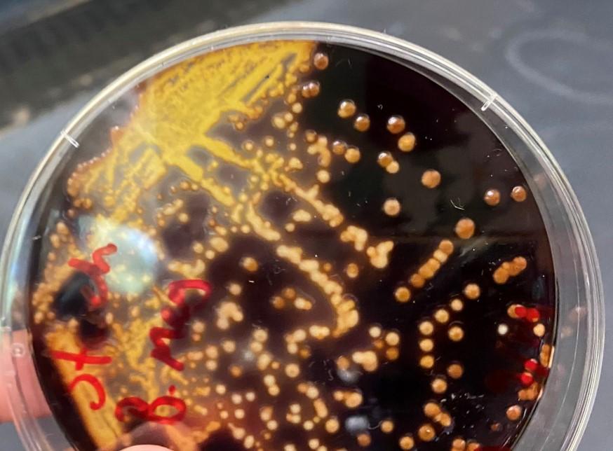 Solved Examine the 2 starch plates (provided in the | Chegg.com