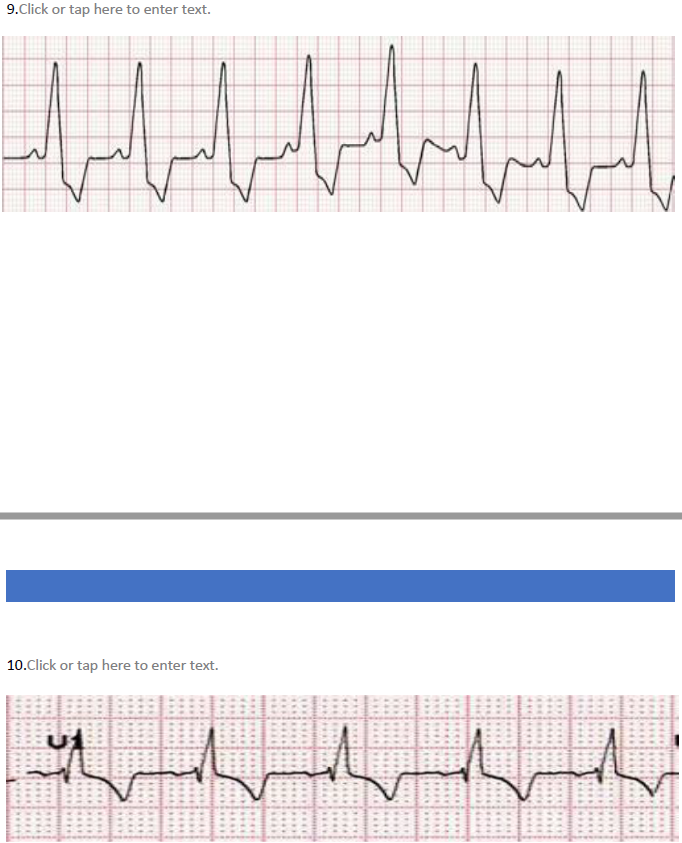 Solved Determine the type of block presented in the rhythm | Chegg.com