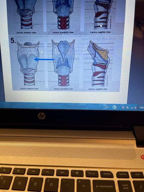 Solved Larynx, anterior view Larynx, posterior view Larynx, | Chegg.com