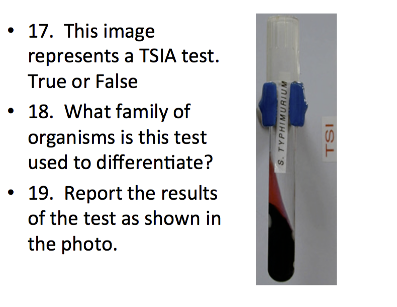 Solved • 17. This image represents a TSIA test. True or | Chegg.com