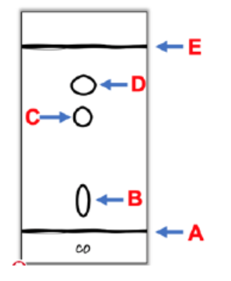 Solved A typical TLC schematic, following the procedure for | Chegg.com