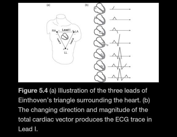 Solved In Figure 5.4 plot the ECG trace for Lead II. In | Chegg.com