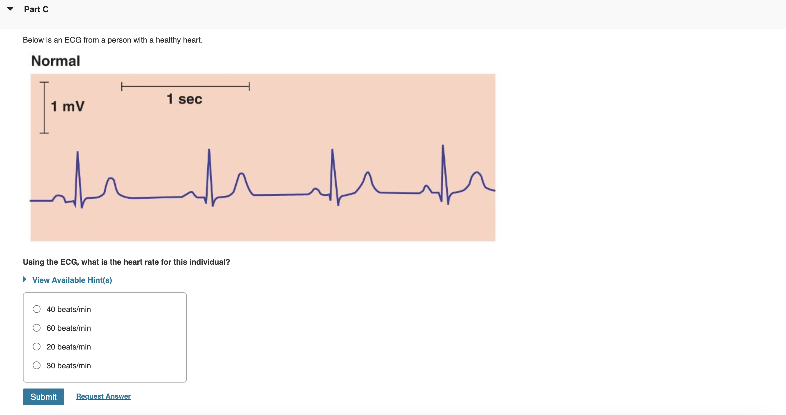 Solved Below is an ECG from a person with a healthy heart. | Chegg.com