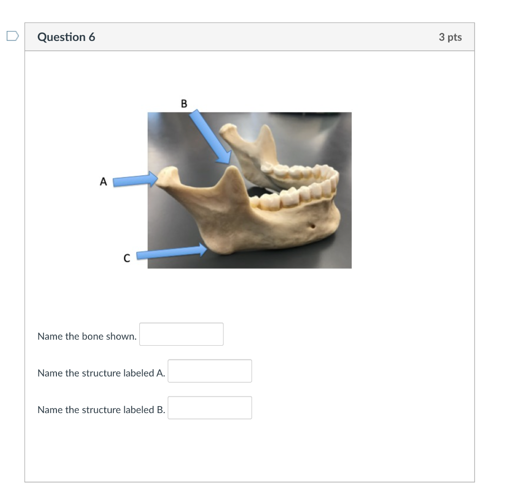 Solved Name the bone shown. Name the structure labeled A. | Chegg.com