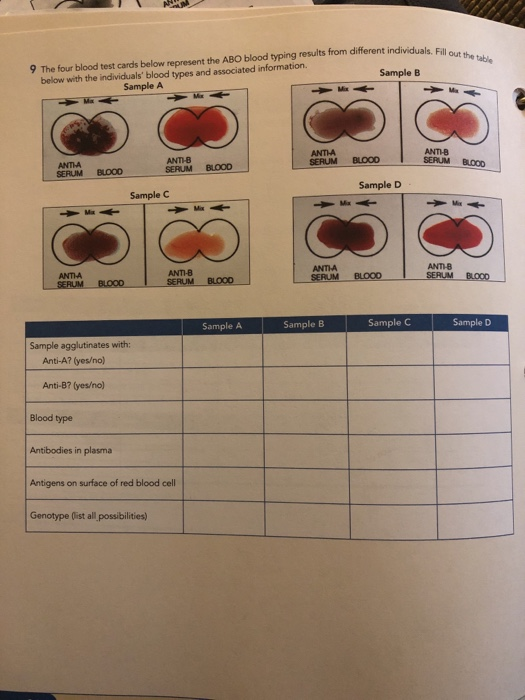 Solved 9 The four blood test cards below represent the ABO | Chegg.com