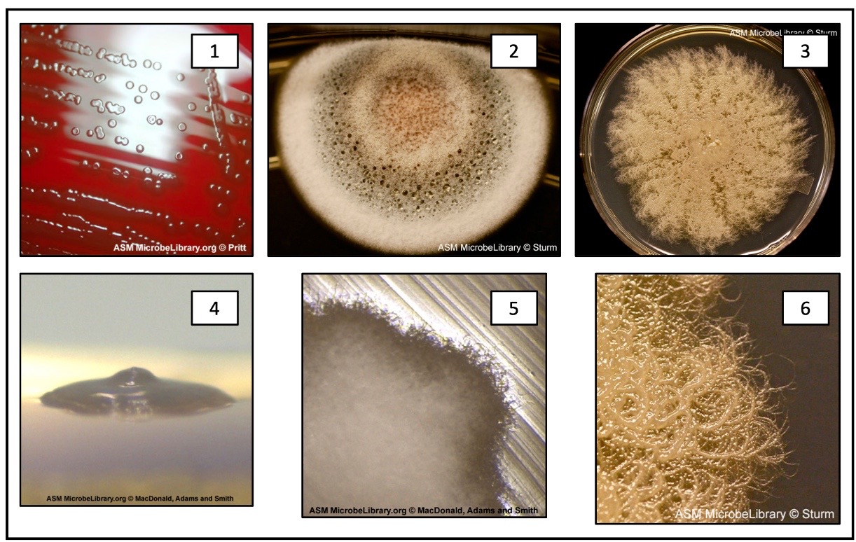 Colony Morphology: Bacterial Colonies For images 3 | Chegg.com