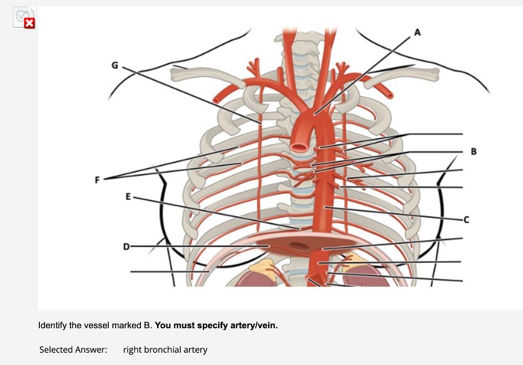 Solved Identify the vessel marked B. You must specify | Chegg.com