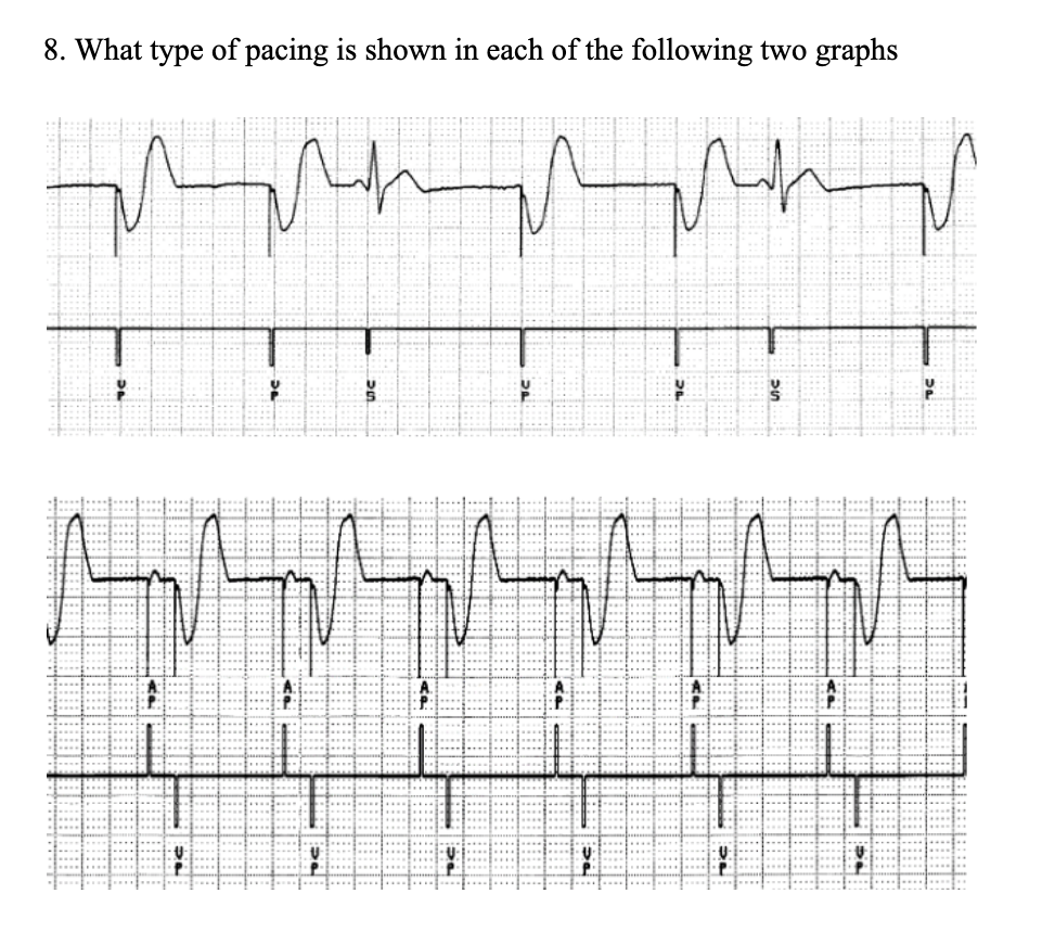 Solved 8. What type of pacing is shown in each of the | Chegg.com