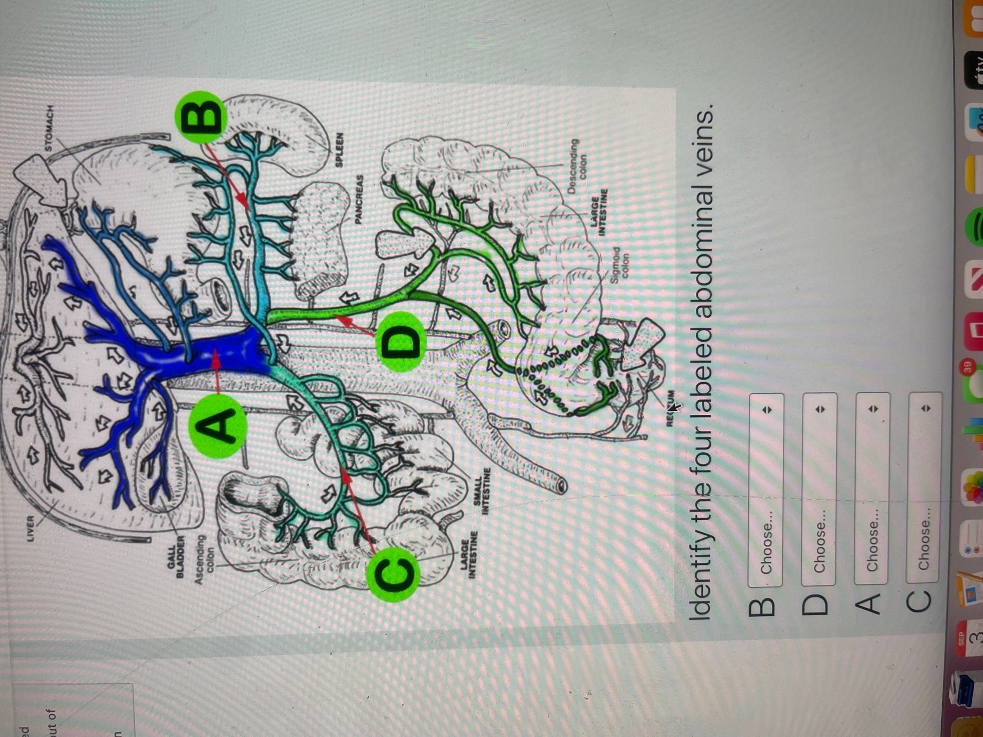 Solved Identify the four labeled abdominal veins. A | Chegg.com