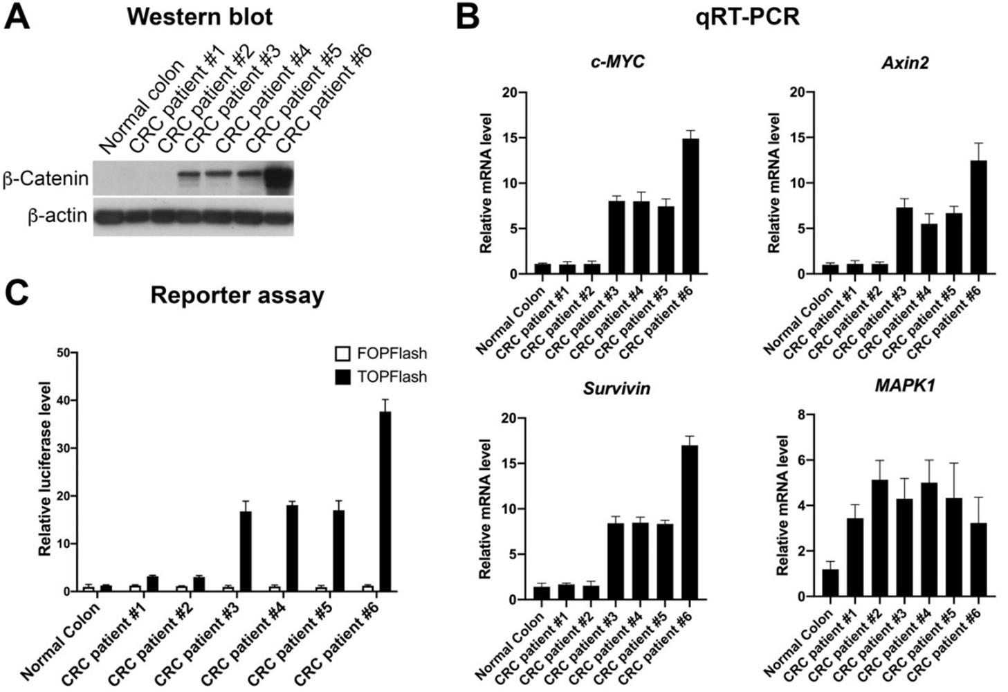 Solved Six colorectal cancer (CRC) patient samples and one | Chegg.com