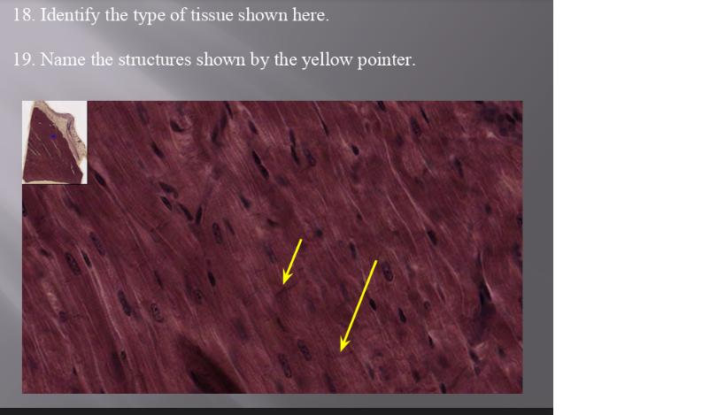 Solved 18. Identify the type of tissue shown here. 19. Name | Chegg.com