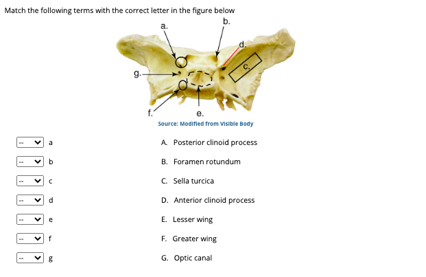 Posterior Clinoid Process