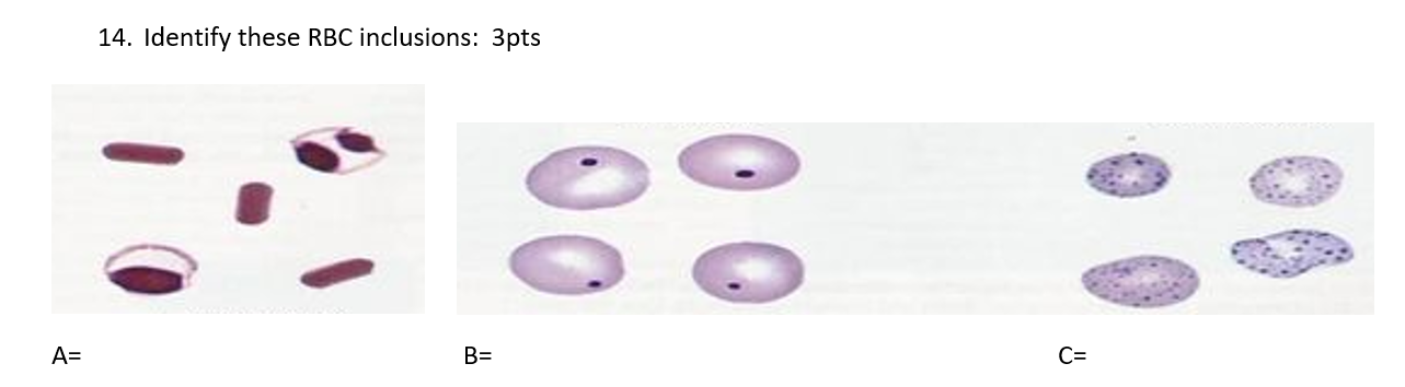 Solved 14. Identify these RBC inclusions: 3pts A= B= C= | Chegg.com
