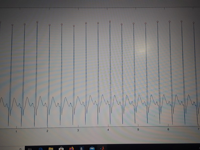 Solved calculate the heart rate of a patient if the RR | Chegg.com
