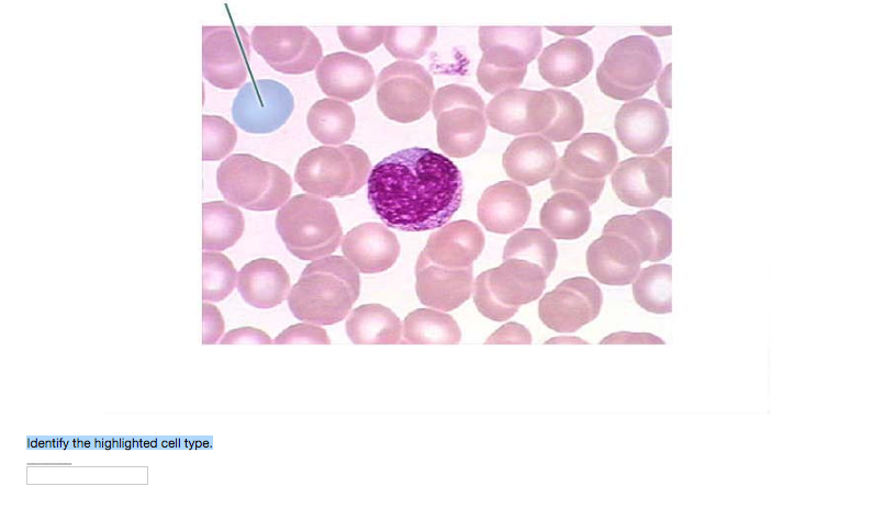 Solved Identify The Highlighted Cell Type Chegg