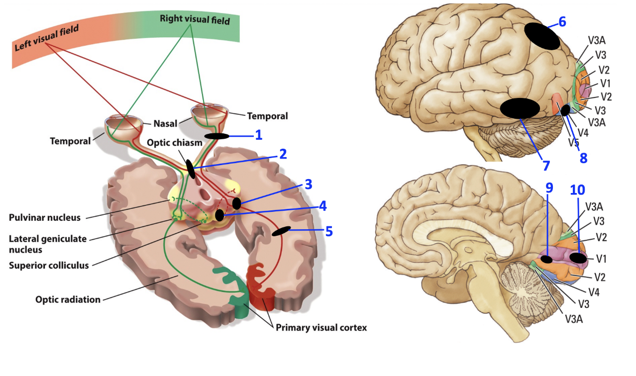 Solved This question requires the PDF file “Q2_figure”: In | Chegg.com