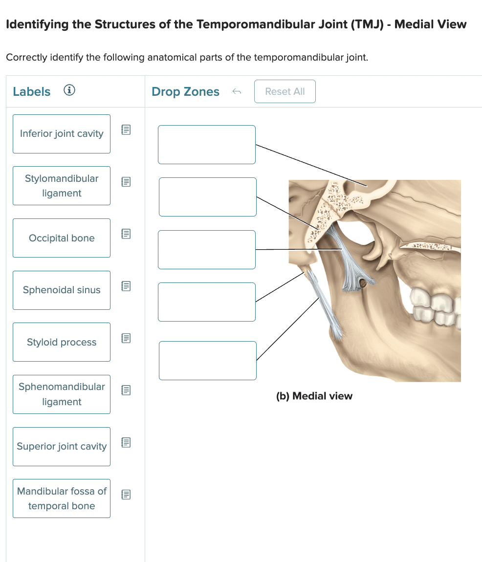 Solved Identifying the Structures of the Temporomandibular | Chegg.com