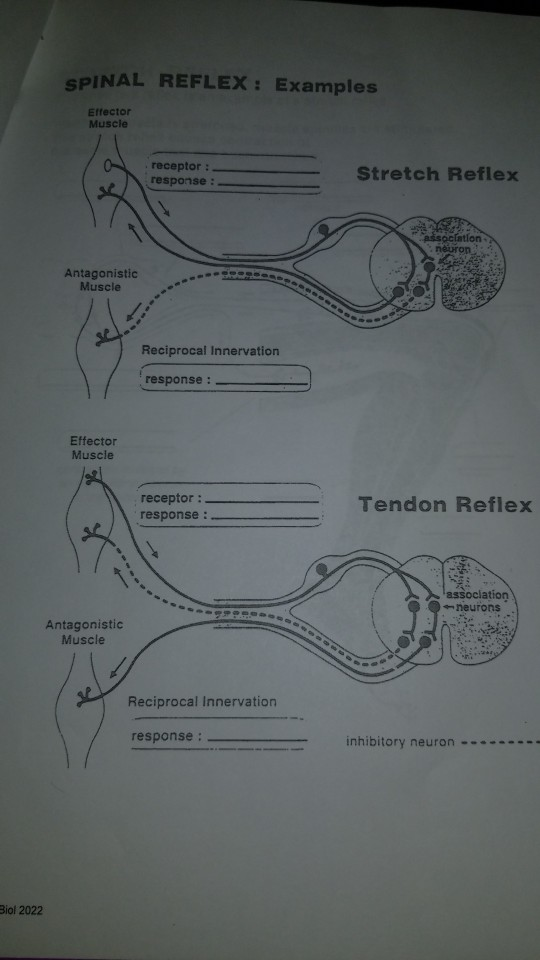 Solved SPINAL REFLEX: Examples Effector Muscle receptor : | Chegg.com