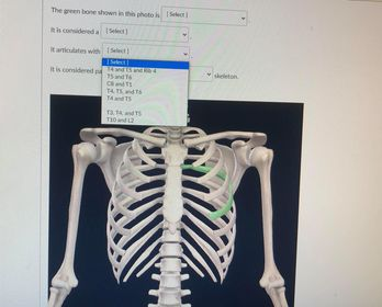 Solved 1.The green bone shown in this photo is ... (a)rib | Chegg.com