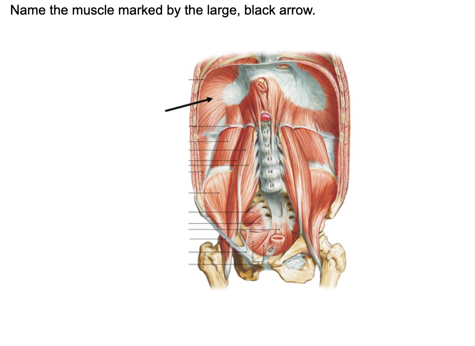Solved Name the muscle marked by the large, black arrow. | Chegg.com