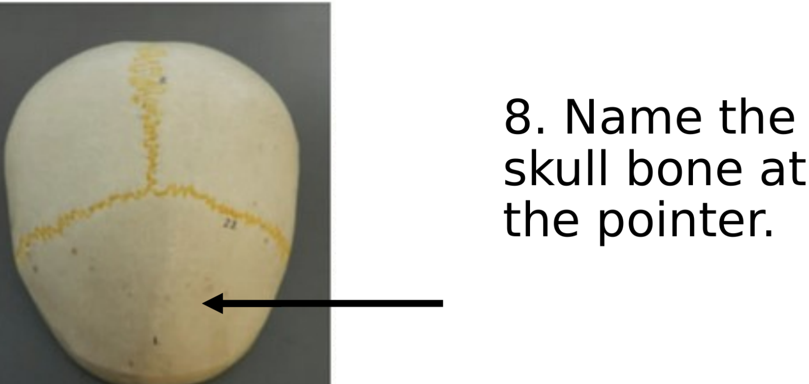 Solved 8. Name the skull bone at the pointer. 23 9. Name | Chegg.com