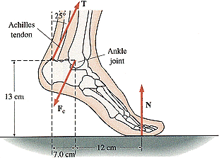 Solved Figure 14-42 shows the foot and lower leg of a person | Chegg.com