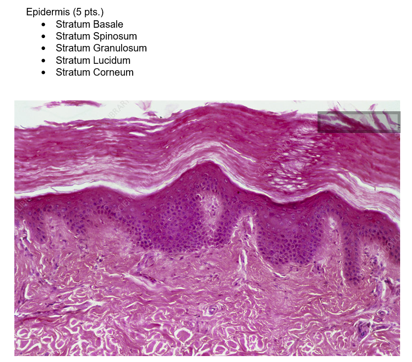 Solved Dermis (3 pts.) • Papillary layer Reticular layer | Chegg.com