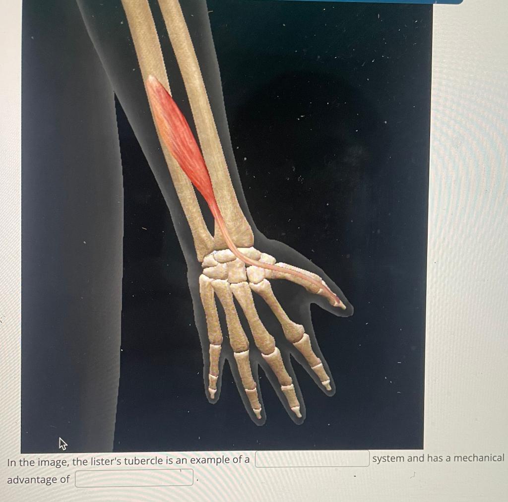 Solved In the image, the lister's tubercle is an example of | Chegg.com