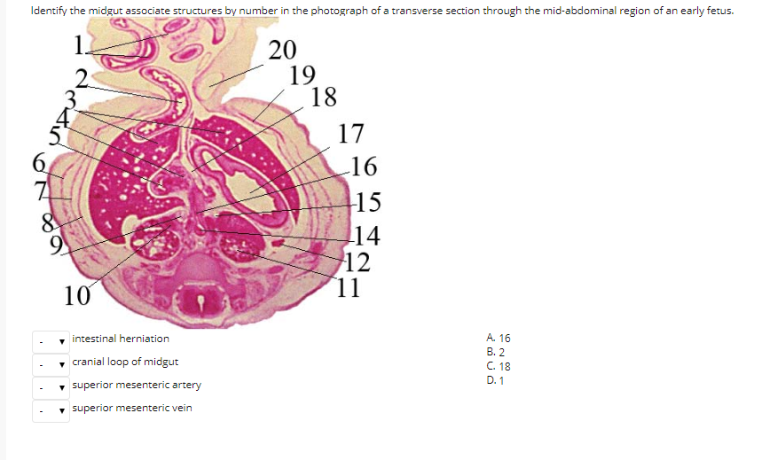 Solved ldentify the midgut associate structures by number in | Chegg.com