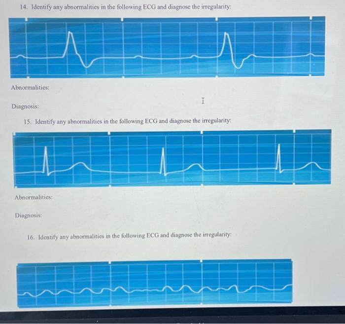 Solved Identify any abnormalities in the following ECG and | Chegg.com