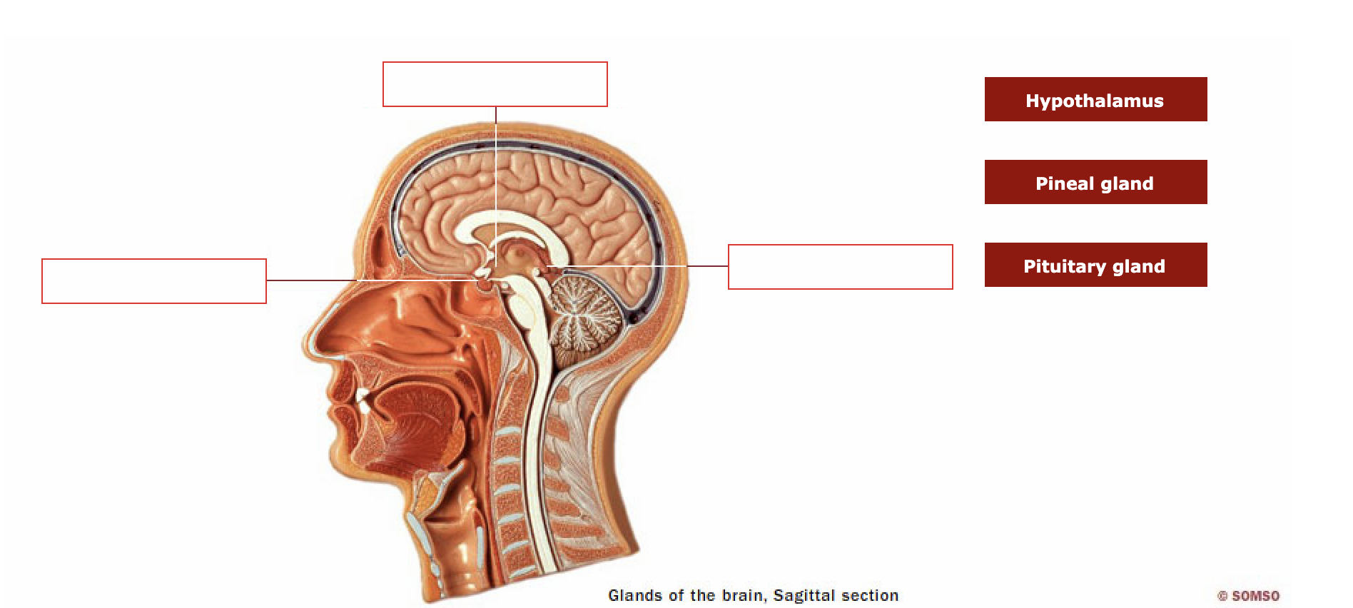 Solved In the figure shown, what gives the indicated | Chegg.com