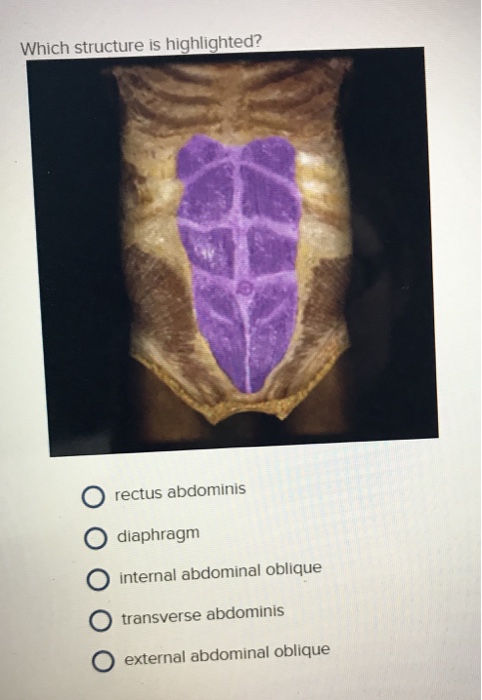Solved Which structure is highlighted? O rectus abdominis | Chegg.com