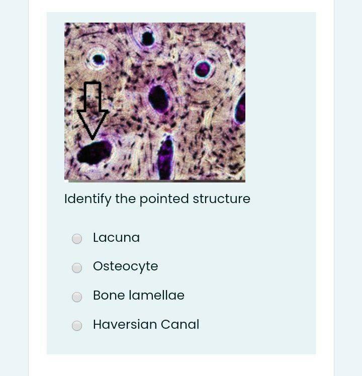 Solved Identify the pointed structure Lacuna Osteocyte Bone | Chegg.com