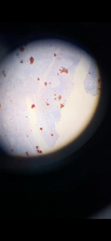 By looking at these images obtained under the | Chegg.com