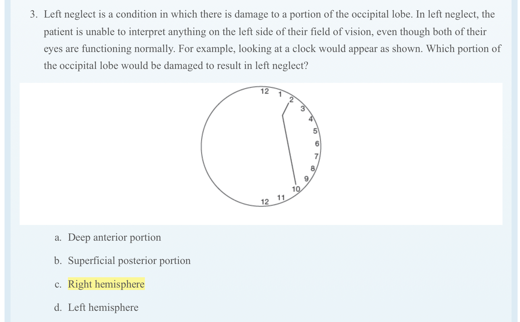 Solved Left neglect is a condition in which there is damage | Chegg.com