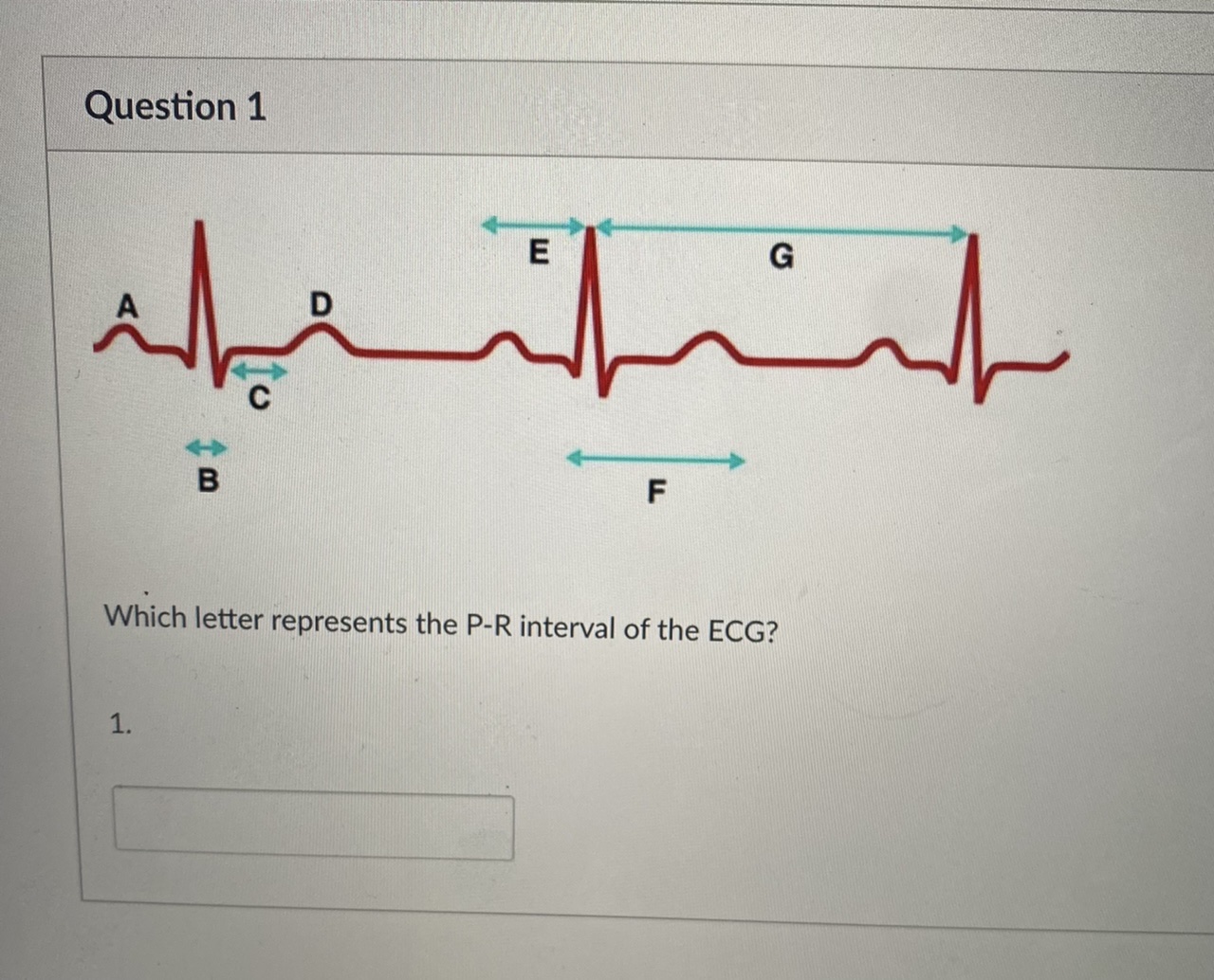 Solved Which letter represents the P-R interval of the ECG? | Chegg.com