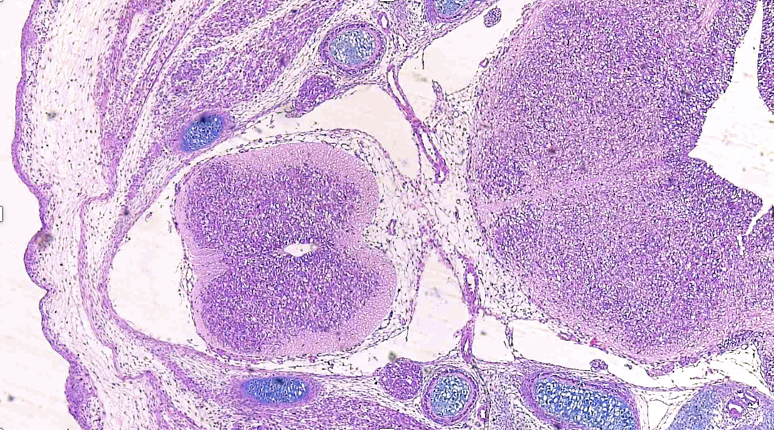 Solved I need help labelling these 2 images, they are | Chegg.com