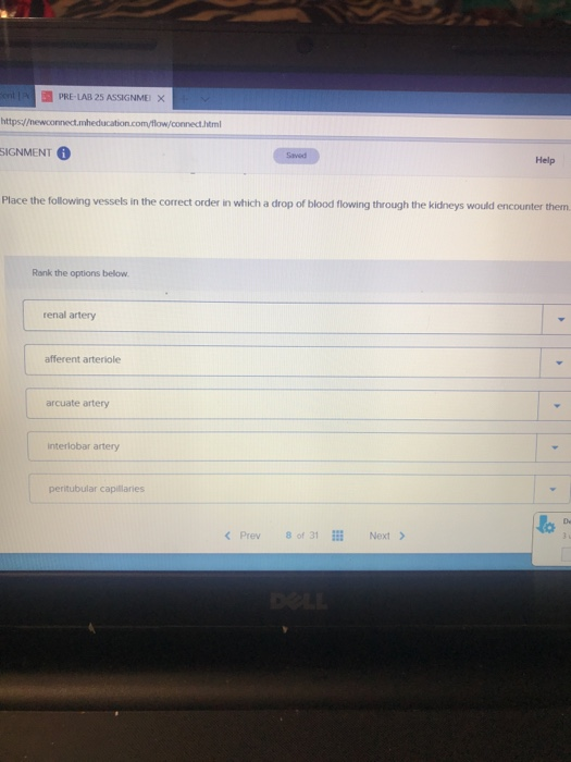 Solved pRE-LAB 25 ASSIGNMEX 仚 ㄧ凸! https://newcorned PRELAB | Chegg.com