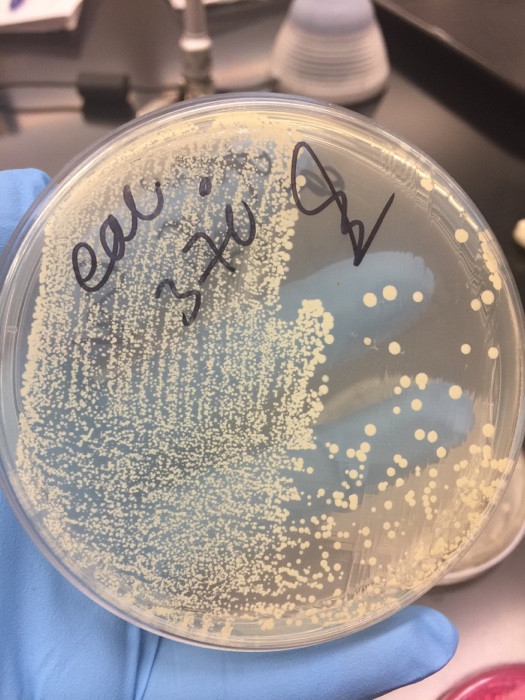 Solved Here is the TSA plates from ear and mouth, | Chegg.com